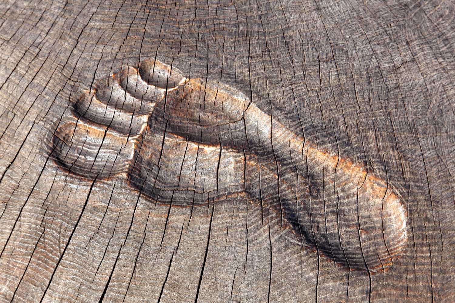 Heel Fissures: How To Heal Your Heels | Sierra Foot & Ankle