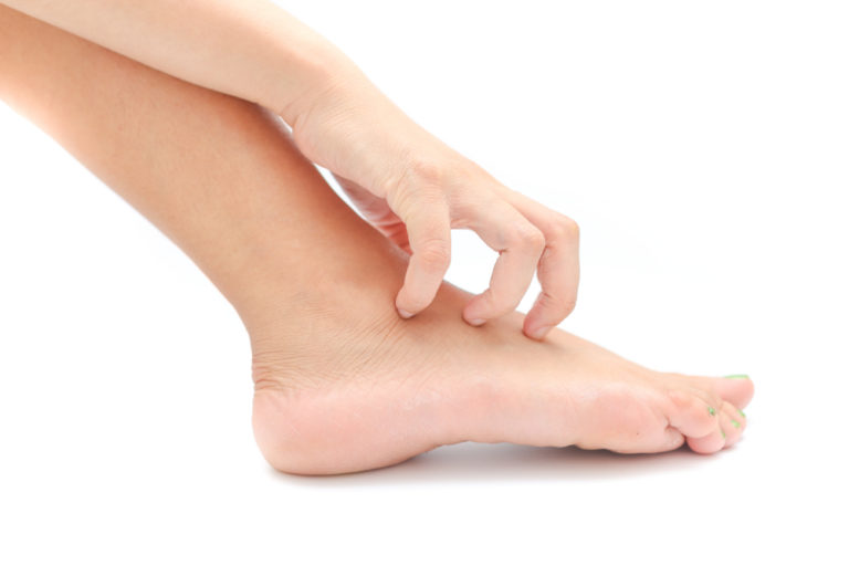 Understanding Foot Allergies | Sierra Foot & Ankle